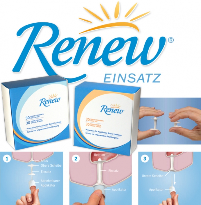Renew Inserts – INNOCEPT Biobedded Medizintechnik GmbH
