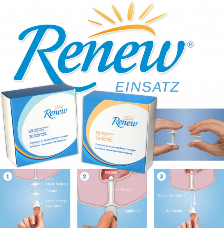 Renew Inserts – INNOCEPT Biobedded Medizintechnik GmbH
